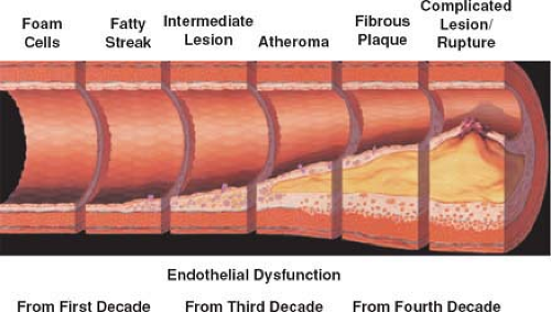 Atherosclerosis: Epidemiology and Pathophysiology | Thoracic Key