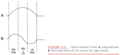 Interpretation of the Normal Electrocardiogram | Thoracic Key