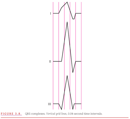 Interpretation of the Normal Electrocardiogram | Thoracic Key