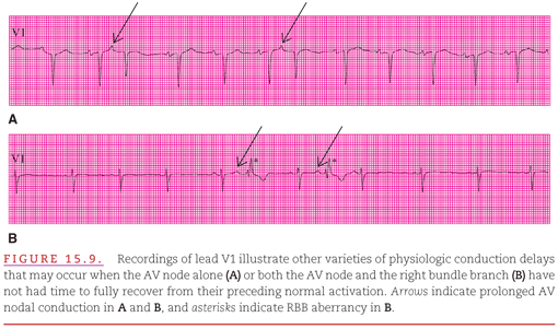 Premature Beats | Thoracic Key