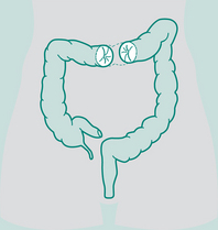 Surgery for adults | Thoracic Key