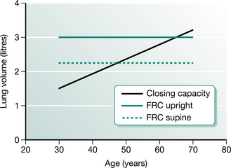 Surgery for adults | Thoracic Key