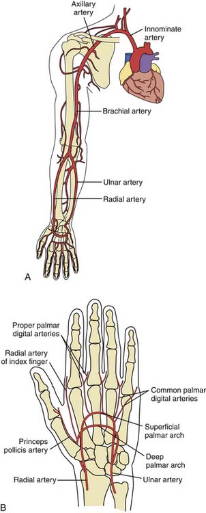 Arterial and Venous Access | Thoracic Key