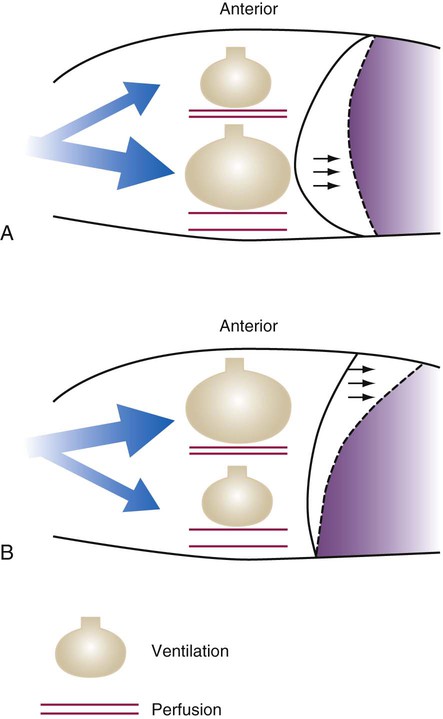 Physiology of Ventilatory Support | Thoracic Key