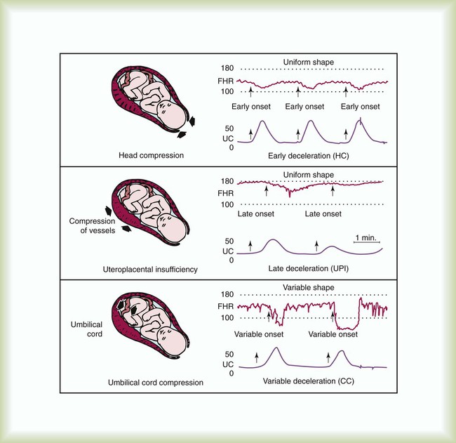 Neonatal and Pediatric Respiratory Care | Thoracic Key