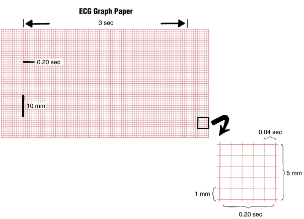 ECG Basics: Waves, Intervals, and Segments | Thoracic Key