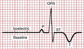 ECG Basics: Waves, Intervals, and Segments | Thoracic Key