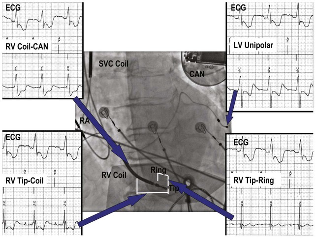 Sensing and Detection | Thoracic Key