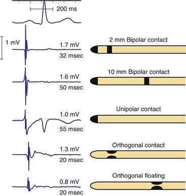Sensing and Detection | Thoracic Key