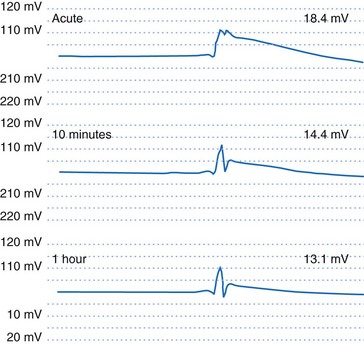 Sensing and Detection | Thoracic Key