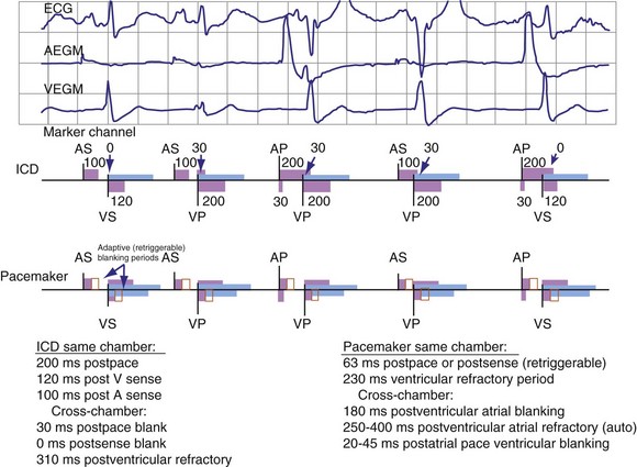 Sensing and Detection | Thoracic Key