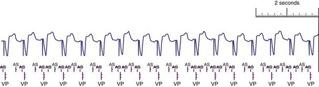 Sensing and Detection | Thoracic Key