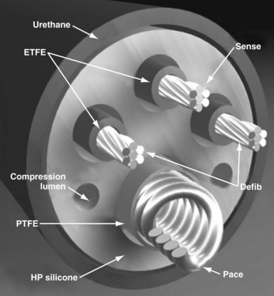 Engineering and Construction of Pacemaker and ICD Leads | Thoracic Key