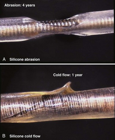 Engineering and Construction of Pacemaker and ICD Leads | Thoracic Key