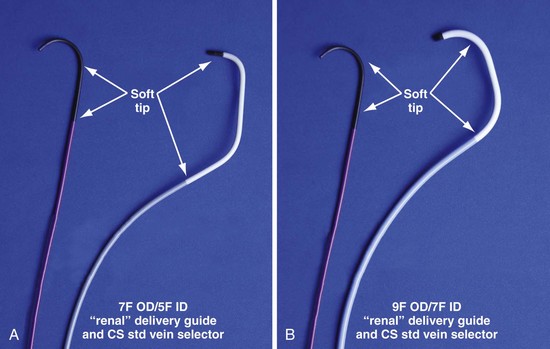 Left Ventricular Lead Implantation | Thoracic Key