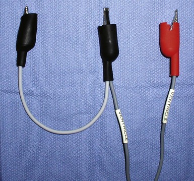 Left Ventricular Lead Implantation | Thoracic Key