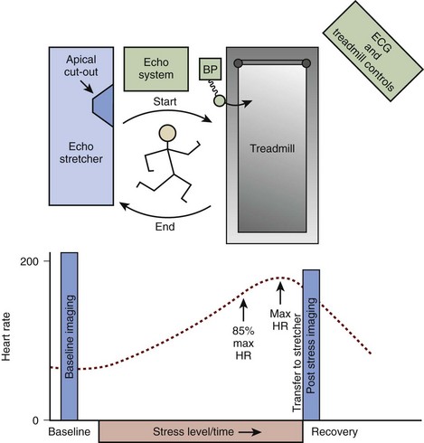 Stress Testing for Structural Heart Disease | Thoracic Key