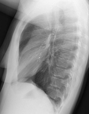 Imaging Techniques | Thoracic Key