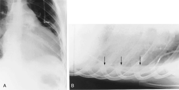 Imaging Techniques | Thoracic Key