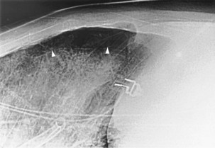 Imaging Techniques | Thoracic Key