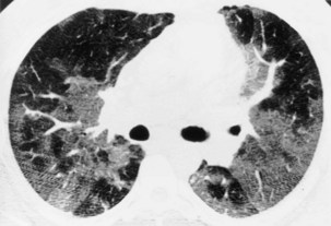Imaging Techniques | Thoracic Key