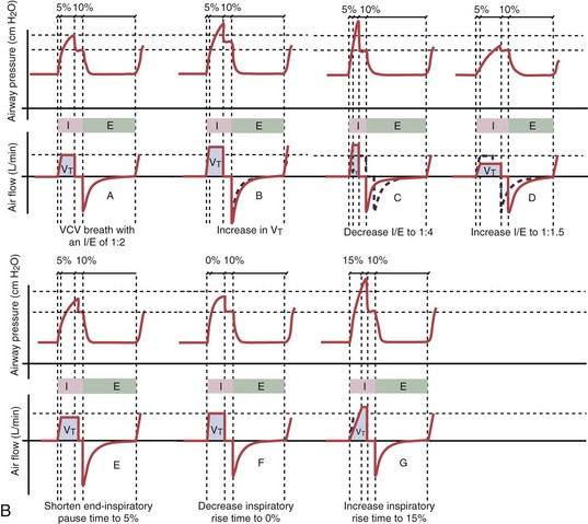 Invasive Mechanical Ventilation | Thoracic Key
