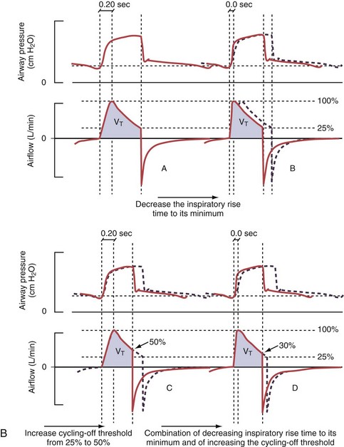 Invasive Mechanical Ventilation | Thoracic Key