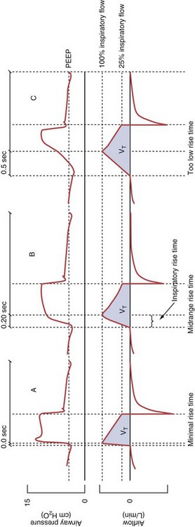 Invasive Mechanical Ventilation | Thoracic Key
