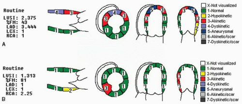 Echocardiography and Coronary Artery Disease | Thoracic Key