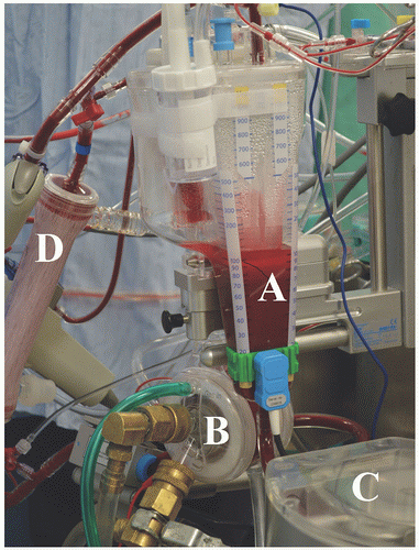 Principles of Oxygenator Function: Gas Exchange, Heat Transfer, and ...