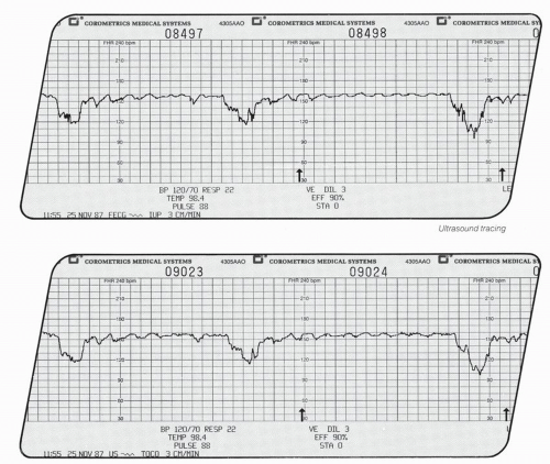 Instrumentation and Artifact Detection Including Fetal Arrhythmias ...