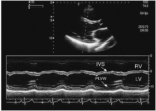 The Echocardiographic Examination | Thoracic Key