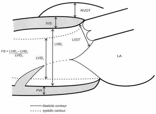Evaluation of Systolic Function of the Left Ventricle | Thoracic Key