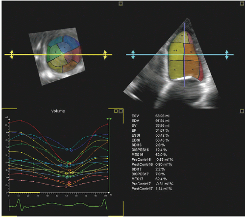 Evaluation of Systolic Function of the Left Ventricle | Thoracic Key
