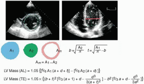 Evaluation of Systolic Function of the Left Ventricle | Thoracic Key