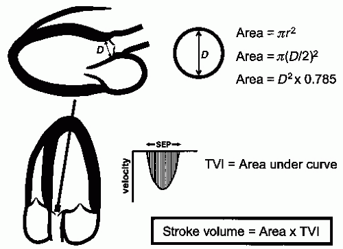 Hemodynamics | Thoracic Key