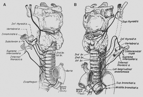 Surgical Anatomy of the Trachea and Techniques of Resection and ...