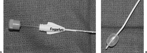 Conduct of Anesthesia | Thoracic Key