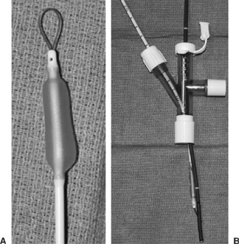 Conduct of Anesthesia | Thoracic Key