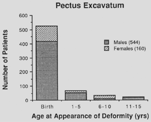 Chest Wall Deformities | Thoracic Key