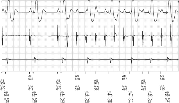 Troubleshooting: Interpreting Diagnostic Information to Ensure ...