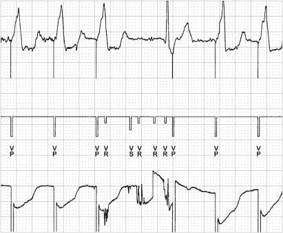 Troubleshooting: Interpreting Diagnostic Information to Ensure ...