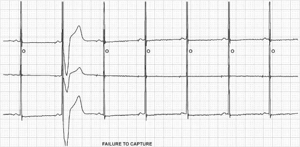 Troubleshooting: Interpreting Diagnostic Information to Ensure ...