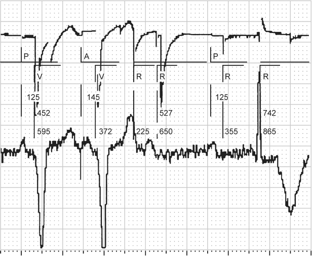 Troubleshooting: Interpreting Diagnostic Information to Ensure ...