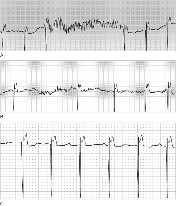 Troubleshooting: Interpreting Diagnostic Information to Ensure ...