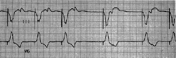 Troubleshooting: Interpreting Diagnostic Information to Ensure ...