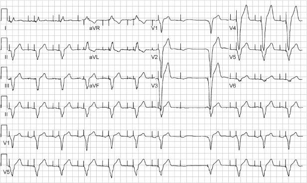 Troubleshooting: Interpreting Diagnostic Information to Ensure ...