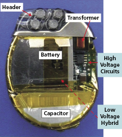 8: The Implantable Cardioverter–Defibrillator | Thoracic Key