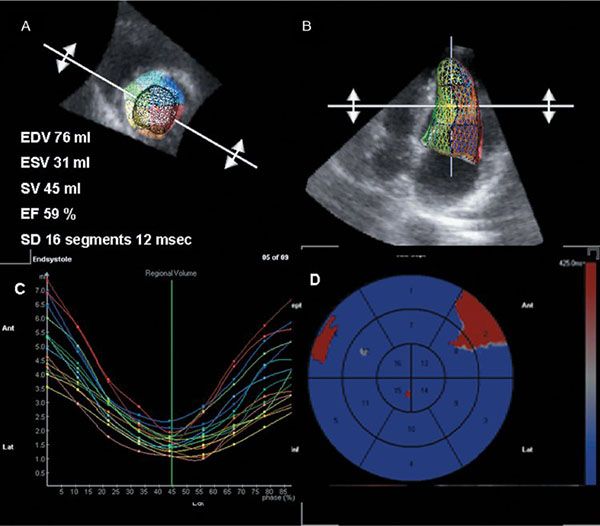 Quantitative Methods in Echocardiography—Advanced Techniques for the ...