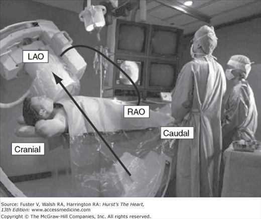 Cardiac Catheterization, Cardiac Angiography, and Coronary Blood Flow ...